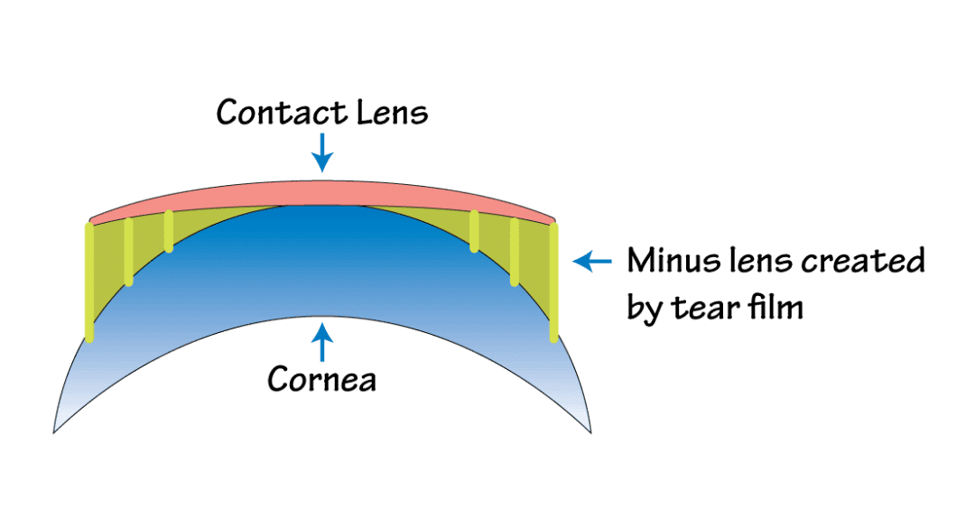 Vertex Distance - OpticianWorks Online Optician Training